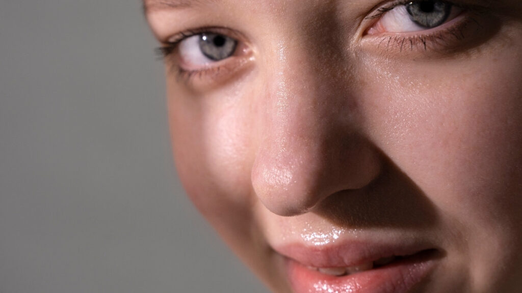 Eat Your Way To Clear Skin: 12 Foods That Combat Acne And Aging Naturally