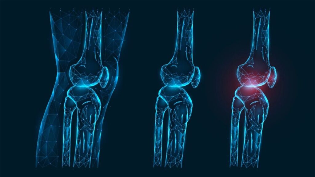 The 14-Day Joint Renewal Protocol: Movements That Reverse Decades Of ...